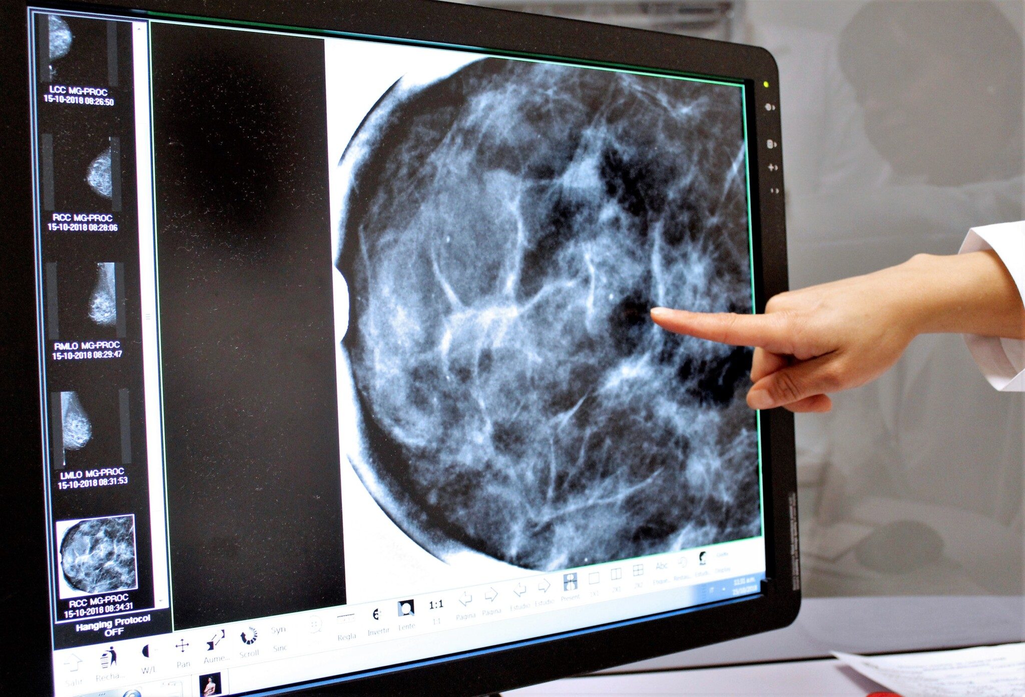 Casi 19 millones de estudios radiológicos al año para optimizar los ...